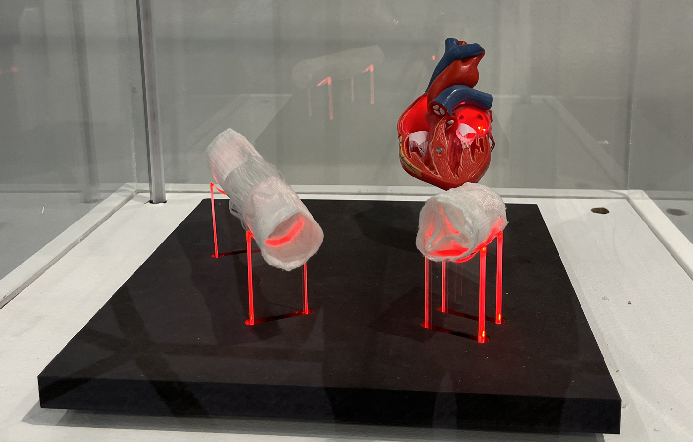 Promise of new seamless heart valve