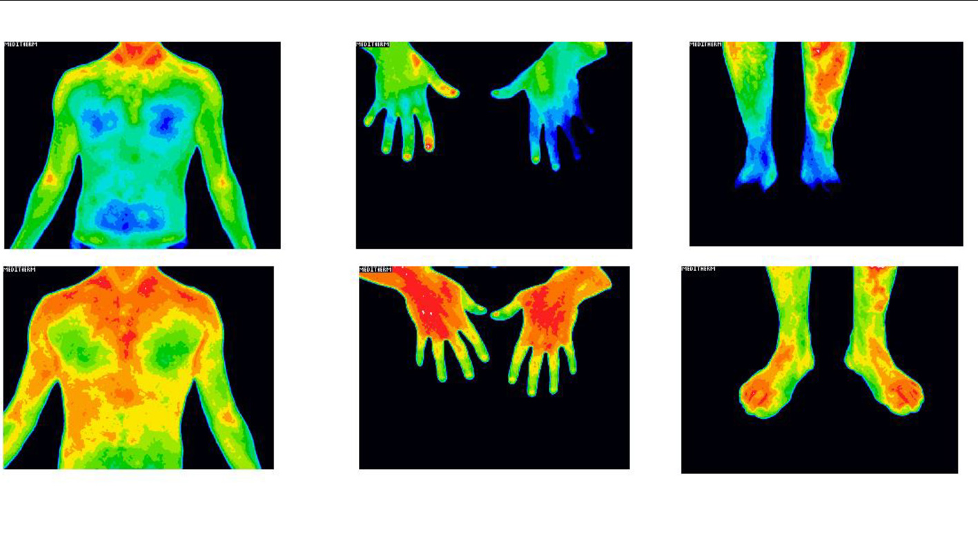 The Nanobionic Super Heat membrane: revolutionising outerwear and beyond